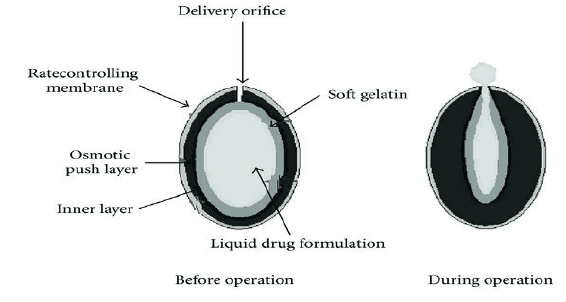 Bilayer Tablets: An Emerging Drug Delivery System | IJPPR