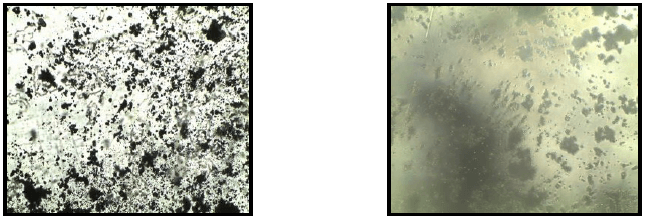 Liquid Crystalline Nanocarriers: Treatment of Dry Eye Syndrome through ...